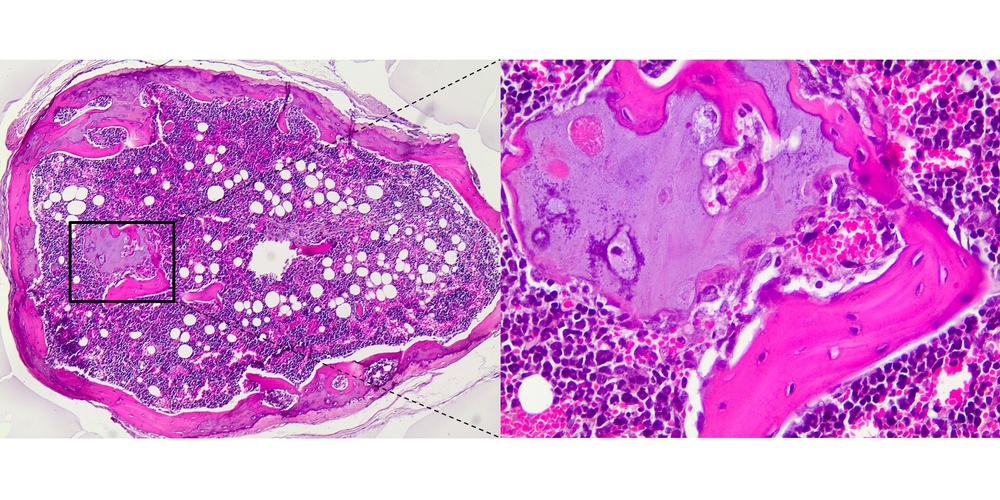 Endochondral Bone Formation Histology